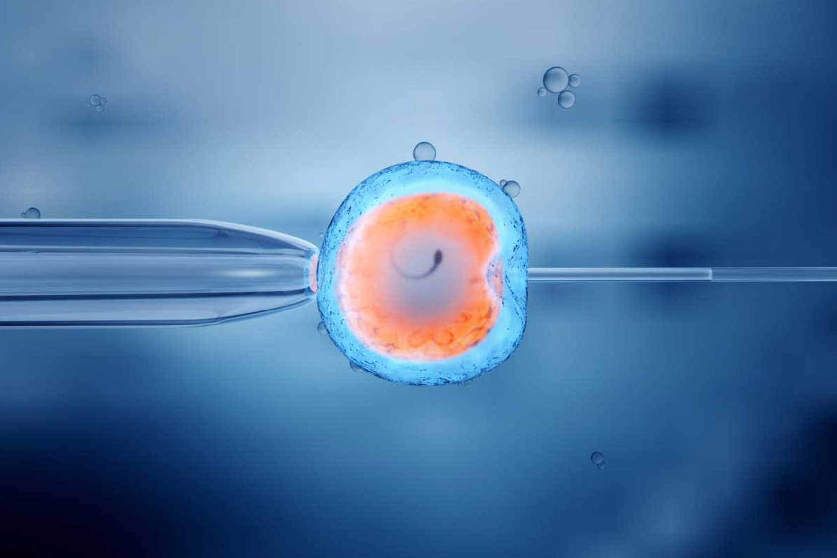 Preimplantation Genetic Testing (PGT) - Santa Barbara Fertility Center